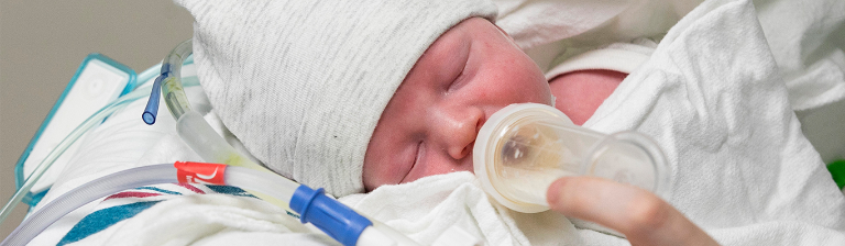 Sham Feeding in Post-Operative Neonates - Le Bonheur Children's Hospital