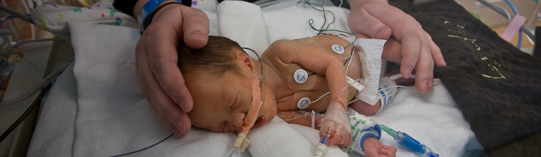 Neonatology - Le Bonheur Children's Hospital